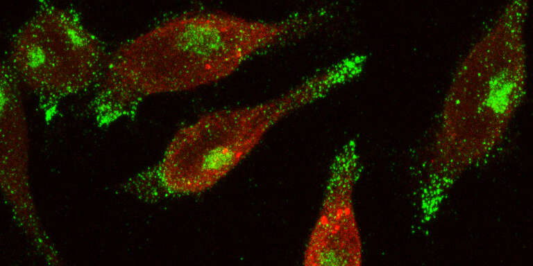 Not necessarily harmful: Protein aggregates in the brain - Biozentrum