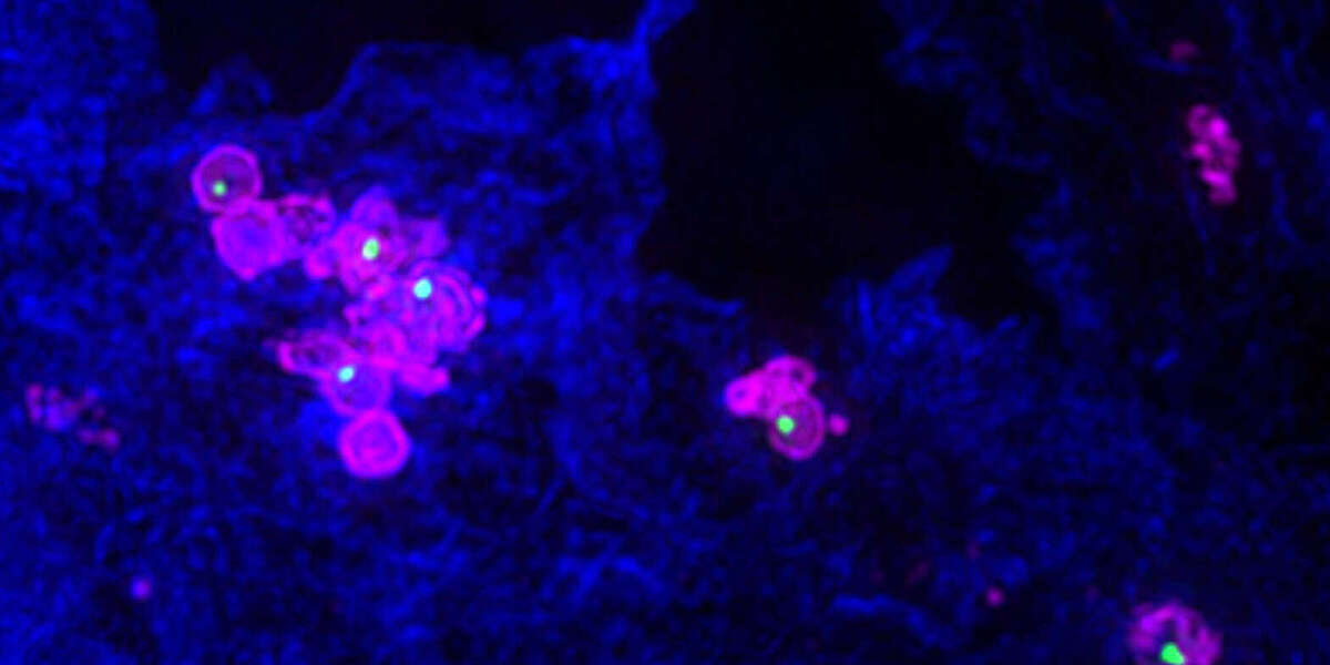 Bacteria free themselves with molecular “speargun” - Biozentrum
